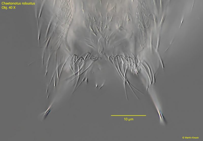 Chaetonotus robustus – Real Micro Life