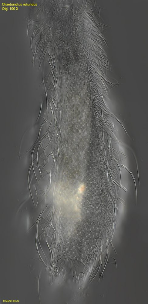 Chaetonotus rotundus – Real Micro Life