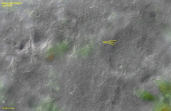 Nassulopsis elegans – Real Micro Life