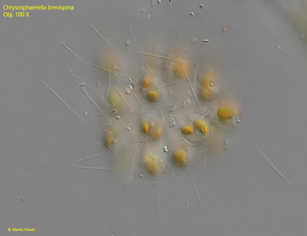 Chrysosphaerella brevispina – Real Micro Life