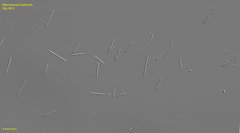 Macromonas fusiformis – Real Micro Life