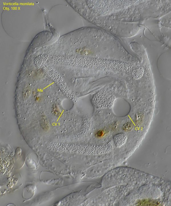 Pseudovorticella monilata – Real Micro Life