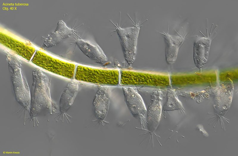Acineta tuberosa – Real Micro Life