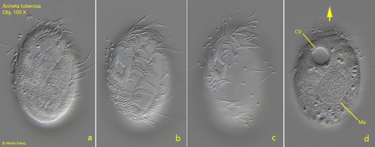 Acineta tuberosa – Real Micro Life