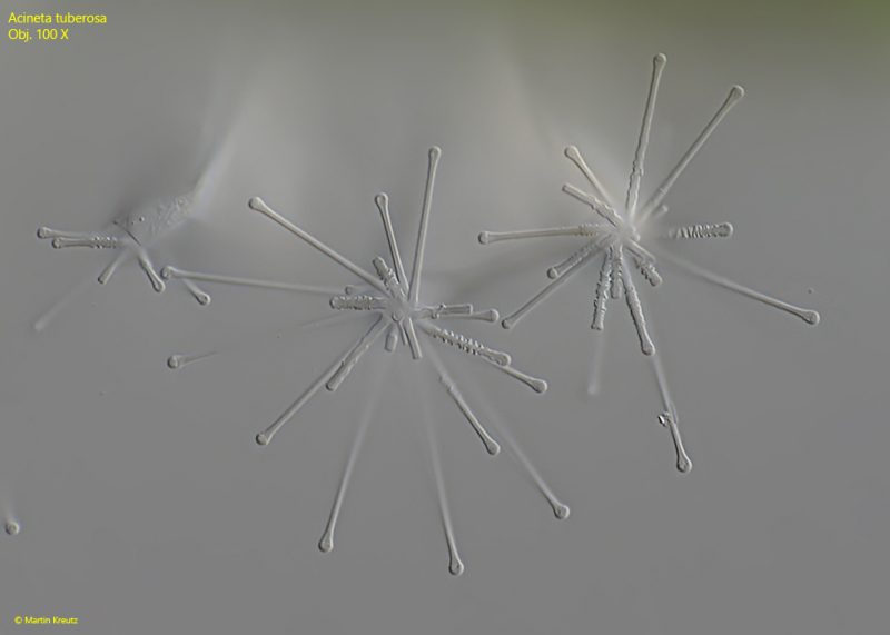 Acineta tuberosa – Real Micro Life