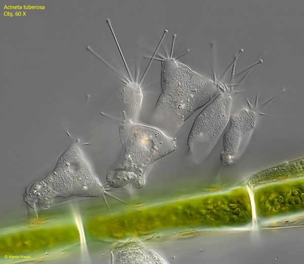 Acineta tuberosa – Real Micro Life