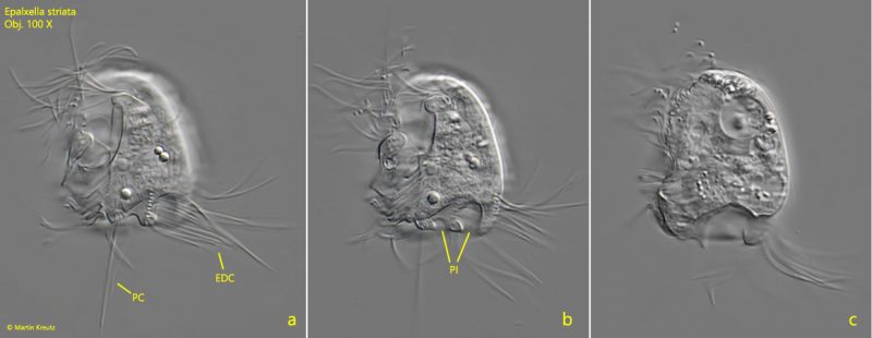 Epalxella exigua – Real Micro Life