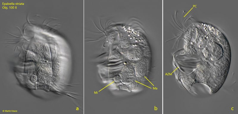 Epalxella striata – Real Micro Life