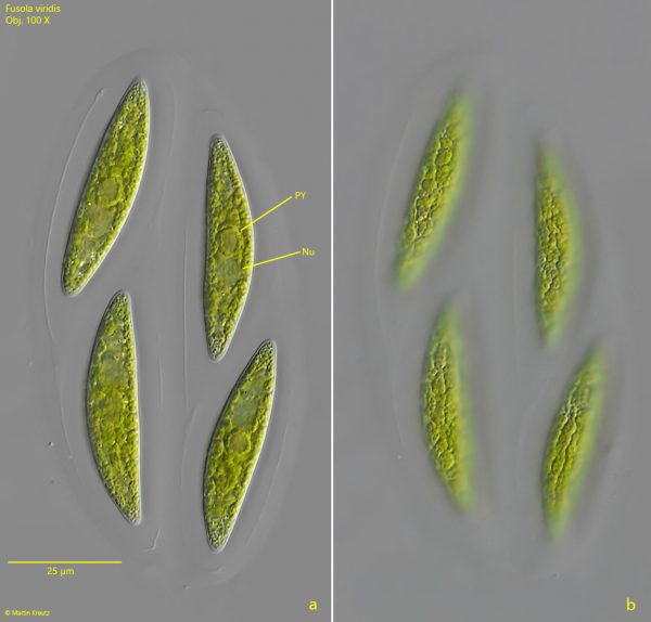 Fusola viridis – Real Micro Life