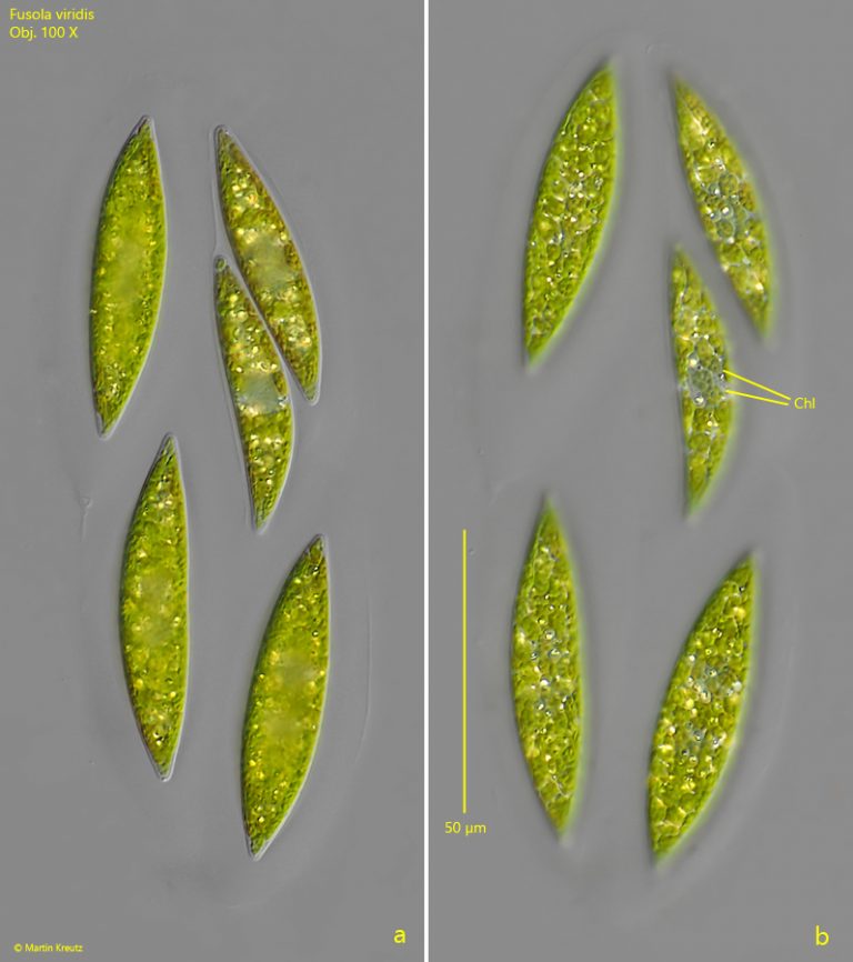 Fusola viridis – Real Micro Life