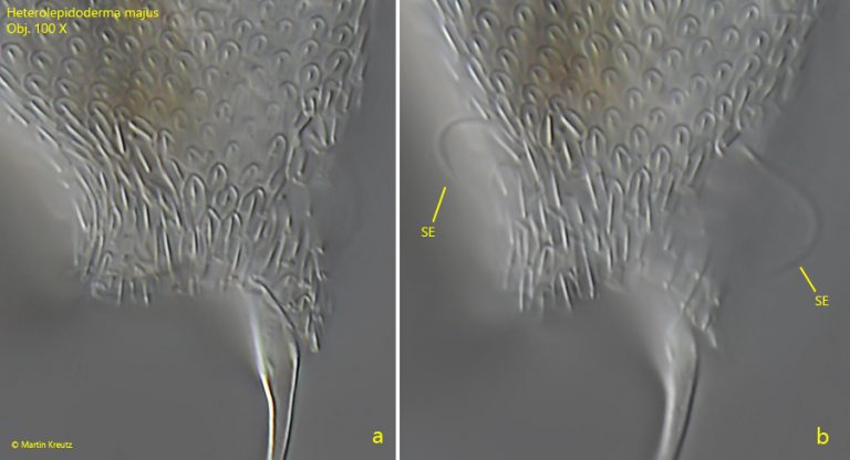 Heterolepidoderma majus – Real Micro Life