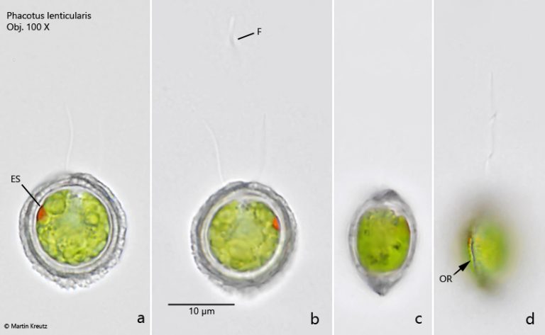 Phacotus lenticularis – Real Micro Life