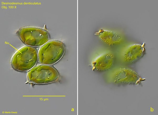 Desmodesmus denticulatus – Real Micro Life
