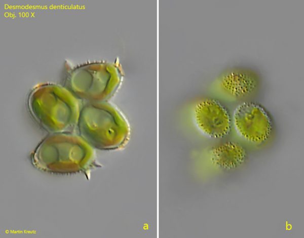 Desmodesmus denticulatus – Real Micro Life