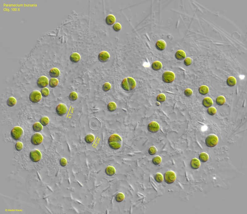 Paramecium bursaria – Real Micro Life