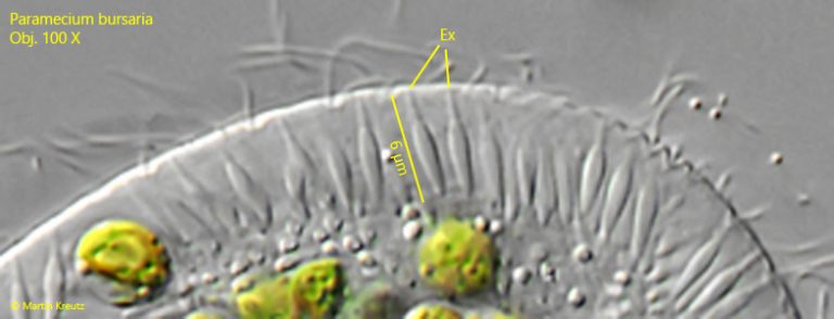 Paramecium bursaria – Real Micro Life
