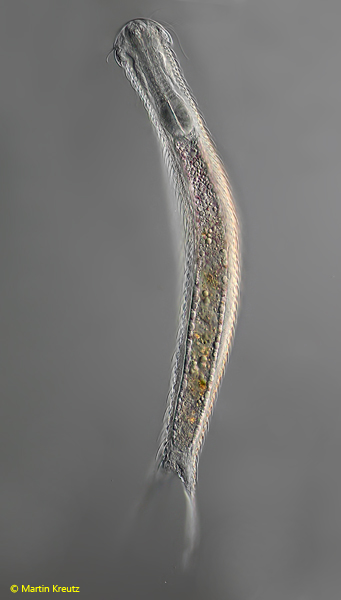 Naked amoeba – Real Micro Life