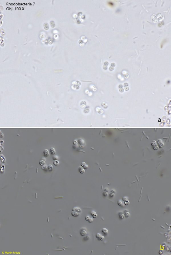 Rhodobacteria 7 – Real Micro Life