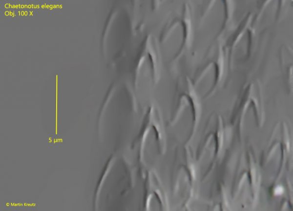 Chaetonotus elegans – Real Micro Life