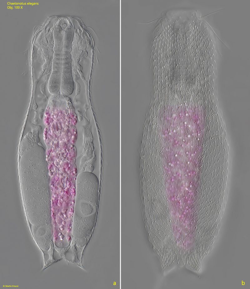 Chaetonotus elegans – Real Micro Life