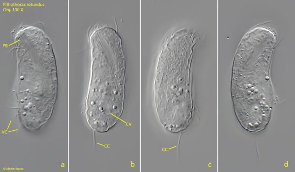 Pithothorax rotundus – Real Micro Life