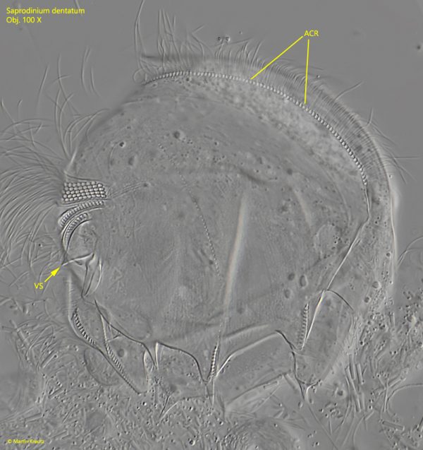 Saprodinium dentatum – Real Micro Life
