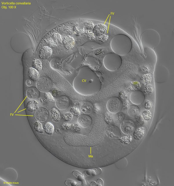 Vorticella convallaria – Real Micro Life