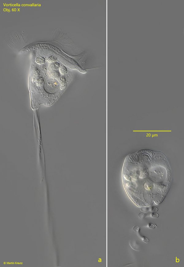 Vorticella convallaria – Real Micro Life