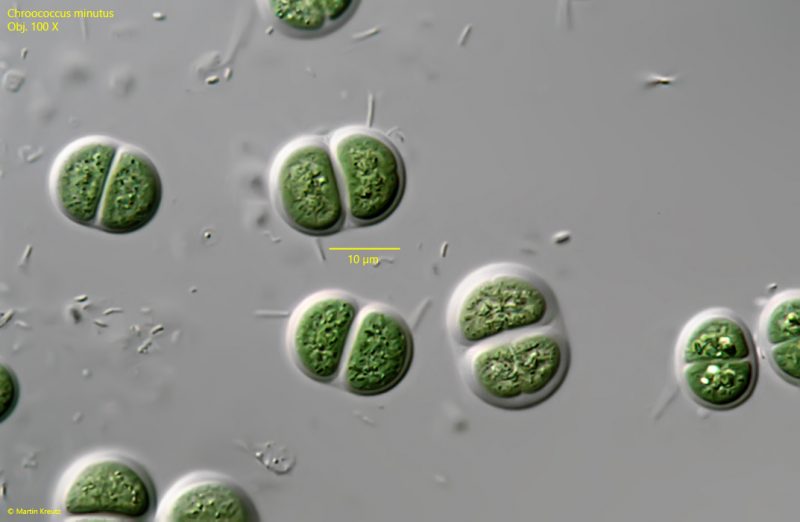 Chroococcus minutus – Real Micro Life