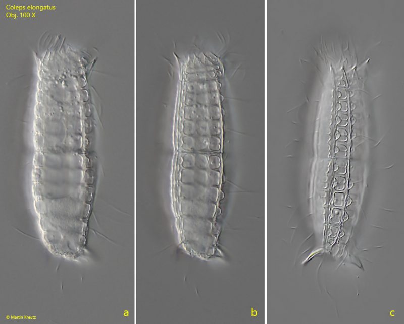 Coleps elongatus – Real Micro Life