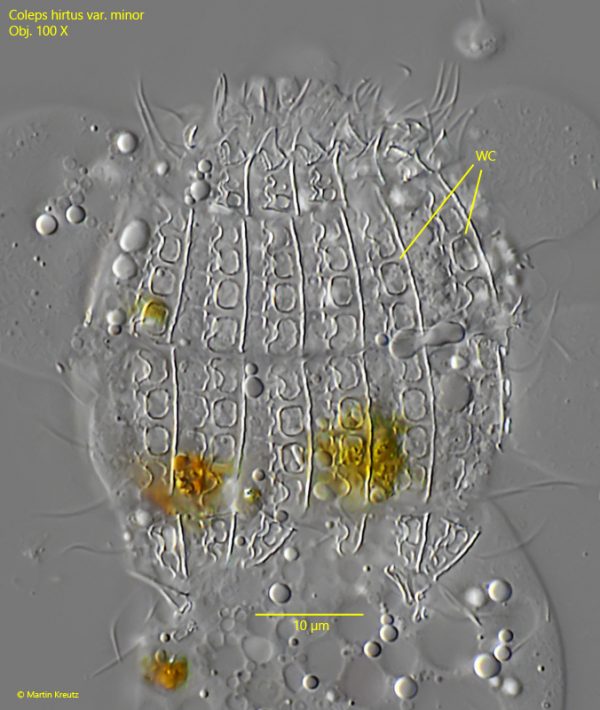 Coleps hirtus var. minor – Real Micro Life