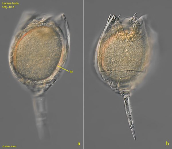 Lecane bulla – Real Micro Life