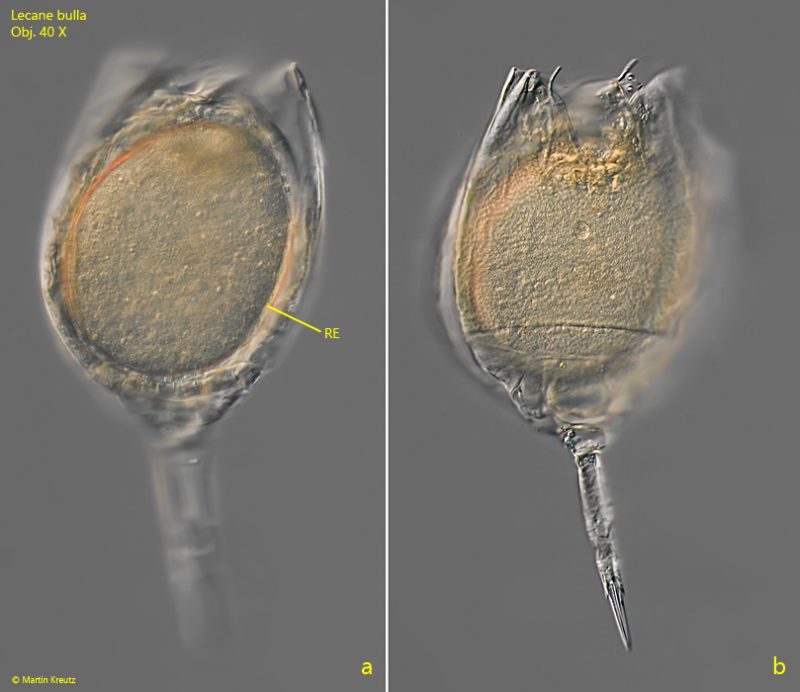 Lecane bulla – Real Micro Life