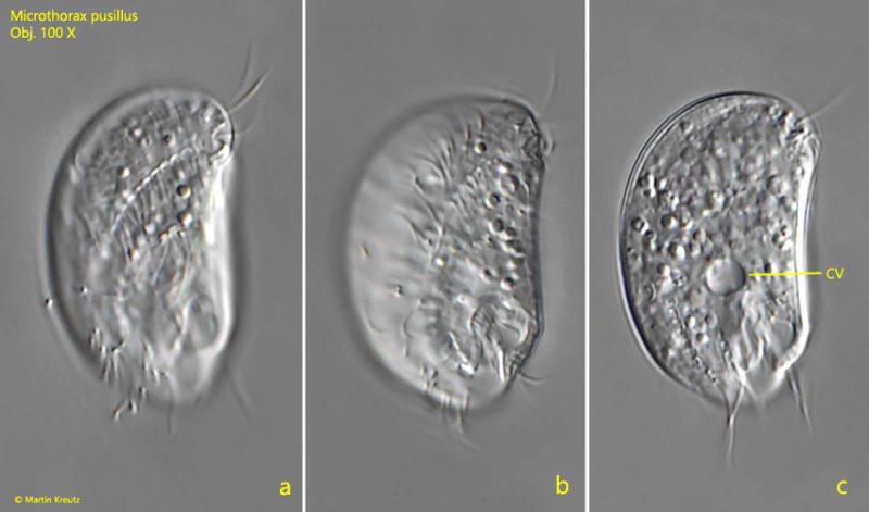Microthorax pusillus – Real Micro Life