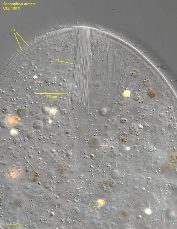 Songophrya armata – Real Micro Life