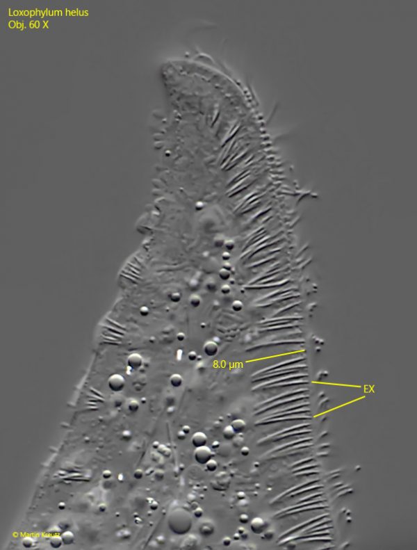 Loxophyllum helus – Real Micro Life