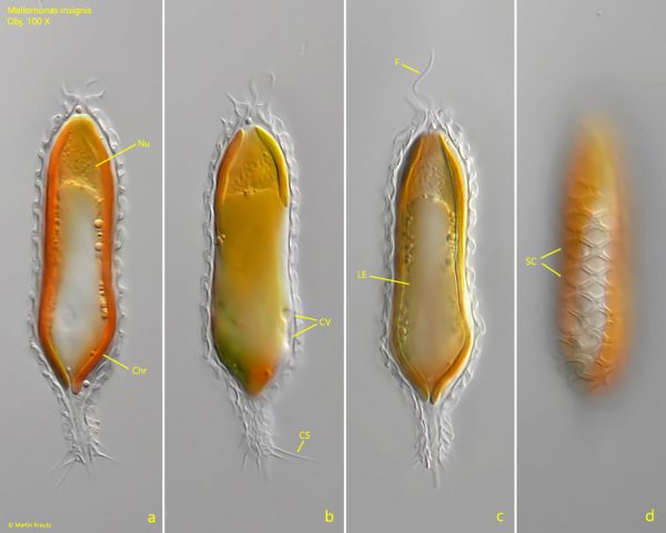 Mallomonas insignis – Real Micro Life