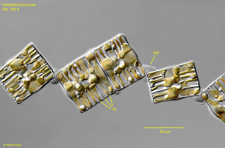 Tabellaria flocculosa – Real Micro Life