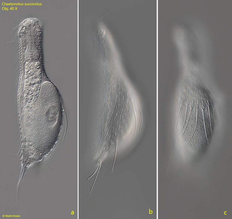 Chaetonotus succinctus – Real Micro Life