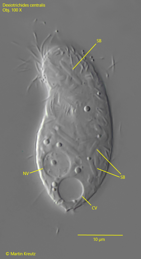 Dexiotrichides centralis – Real Micro Life