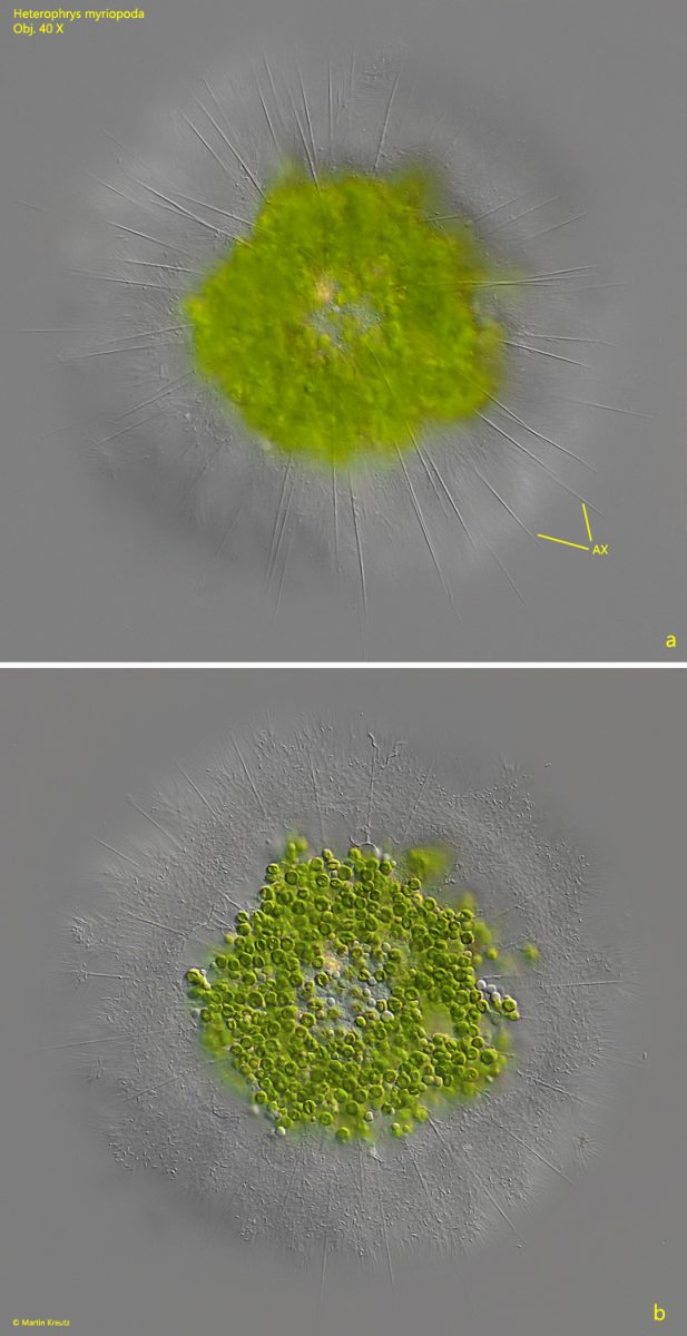 Heterophrys myriopoda – Real Micro Life