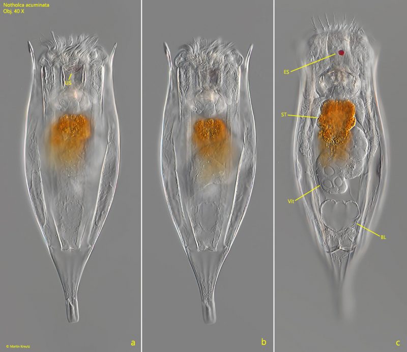 Notholca acuminata – Real Micro Life
