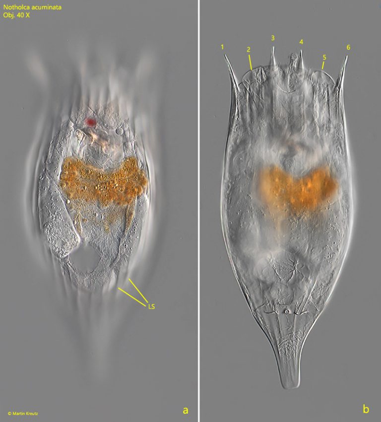 Notholca acuminata – Real Micro Life