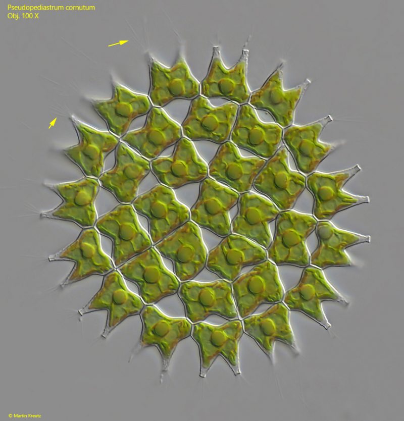 Pseudopediastrum cornutum – Real Micro Life