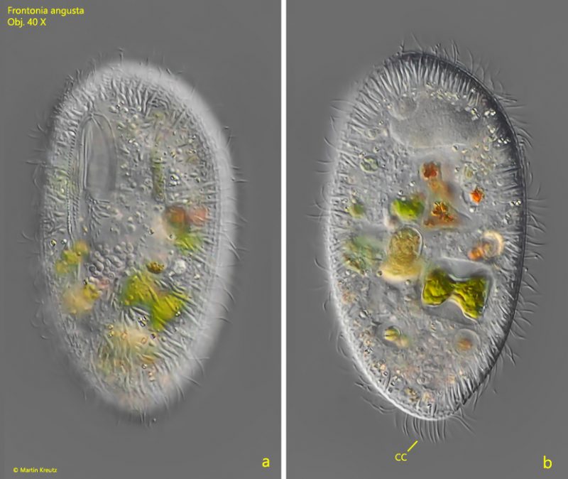 Frontonia angusta – Real Micro Life
