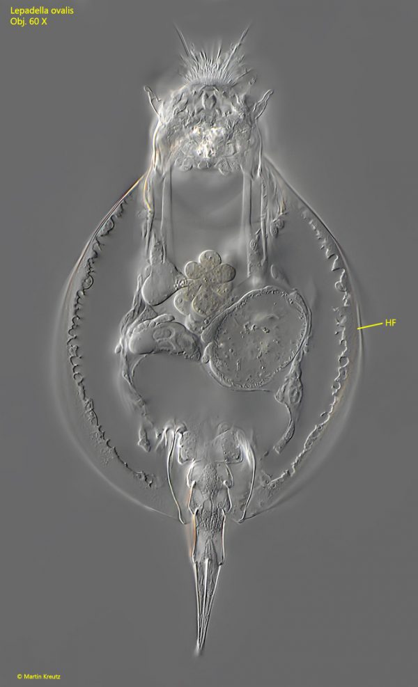 Lepadella ovalis – Real Micro Life