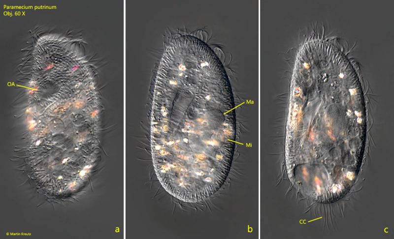 Paramecium putrinum – Real Micro Life