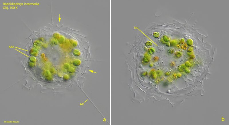 Raphidiophrys intermedia – Real Micro Life