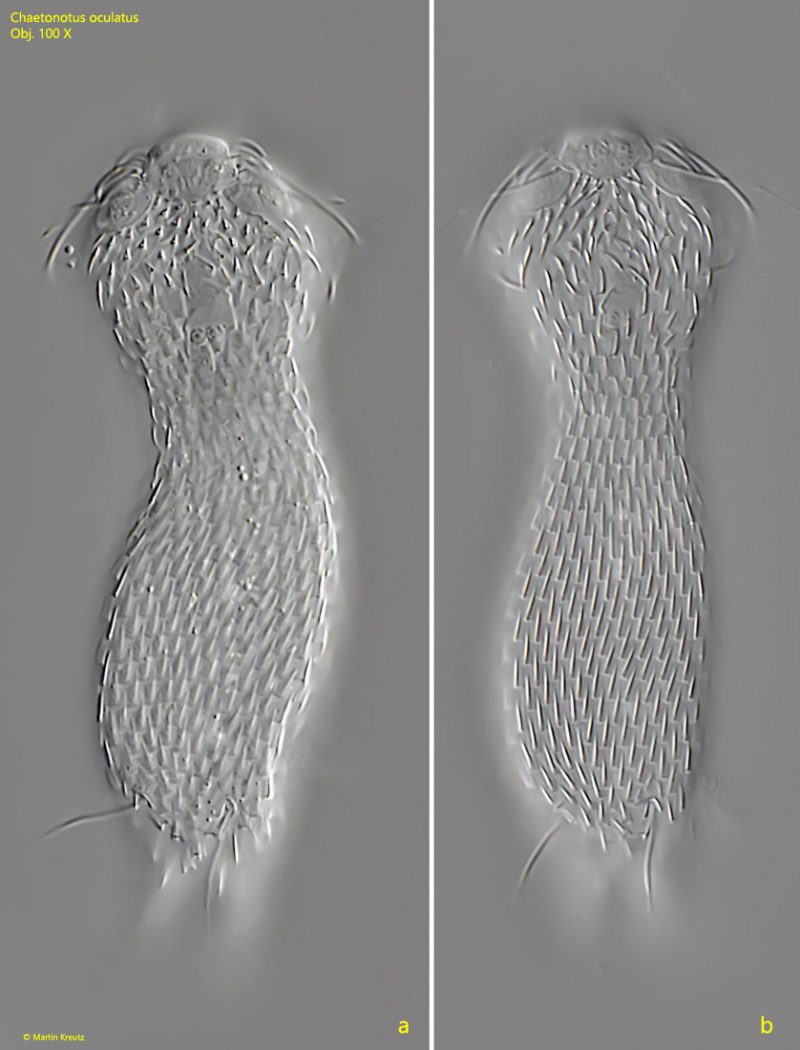 Chaetonotus oculatus – Real Micro Life