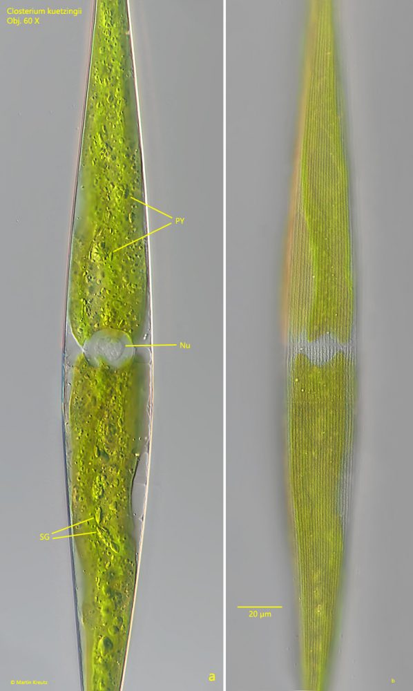 Closterium kuetzingii – Real Micro Life